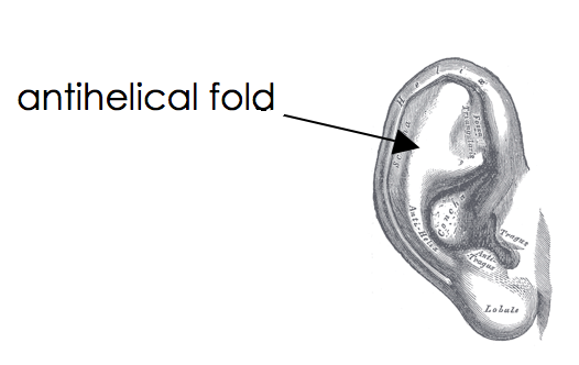 Otoplasty Ear Pinning in Toronto Ontario